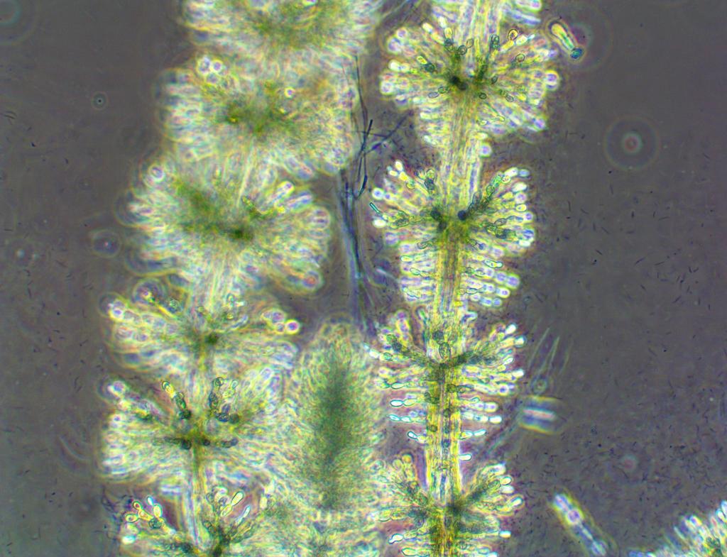 Frog-spawn Algae (Batrachospermum) - Botanical Realm