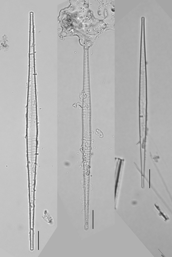 (Ulnaria acus)