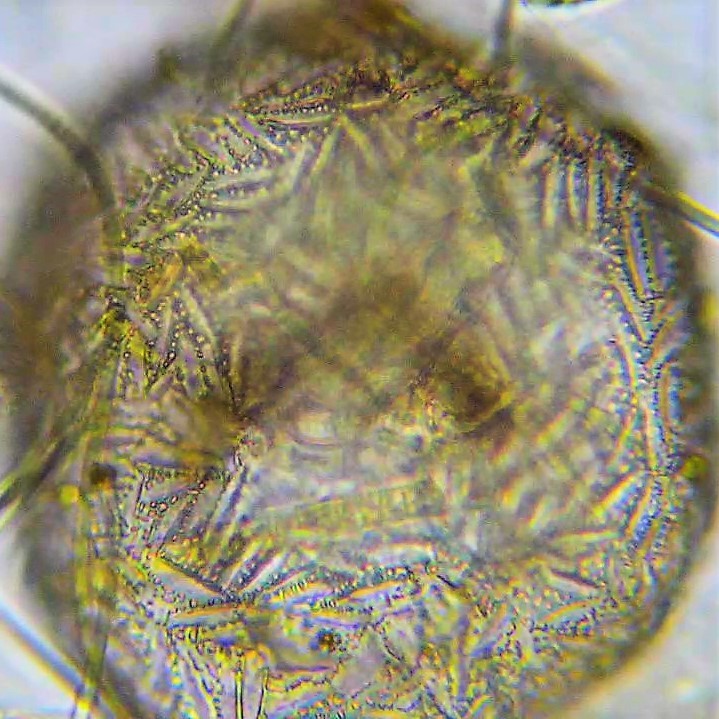 Centropyxis aculeata (Ehrenberg, 1832) Stein, 1859