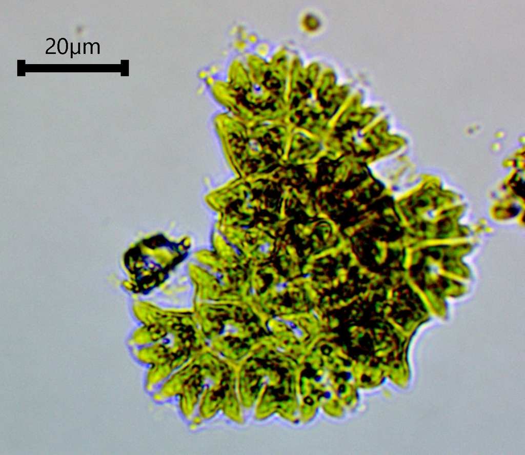 (Pediastrum obtusum) - Botanical Realm