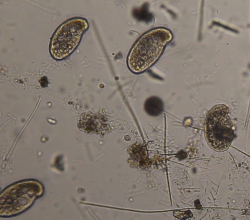 Bobovka velká (Colpidium colpoda)