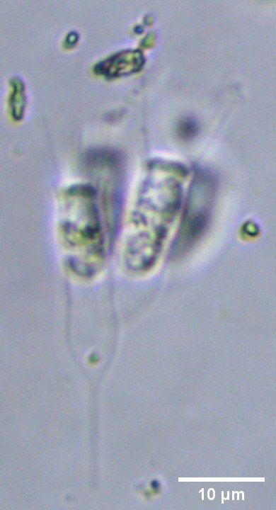 Choanozoa from Canal, Teton Estates, West Jordan, UT 84088, USA on July ...