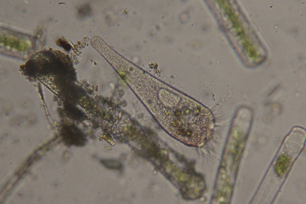 Stentor Under Microscope 40x