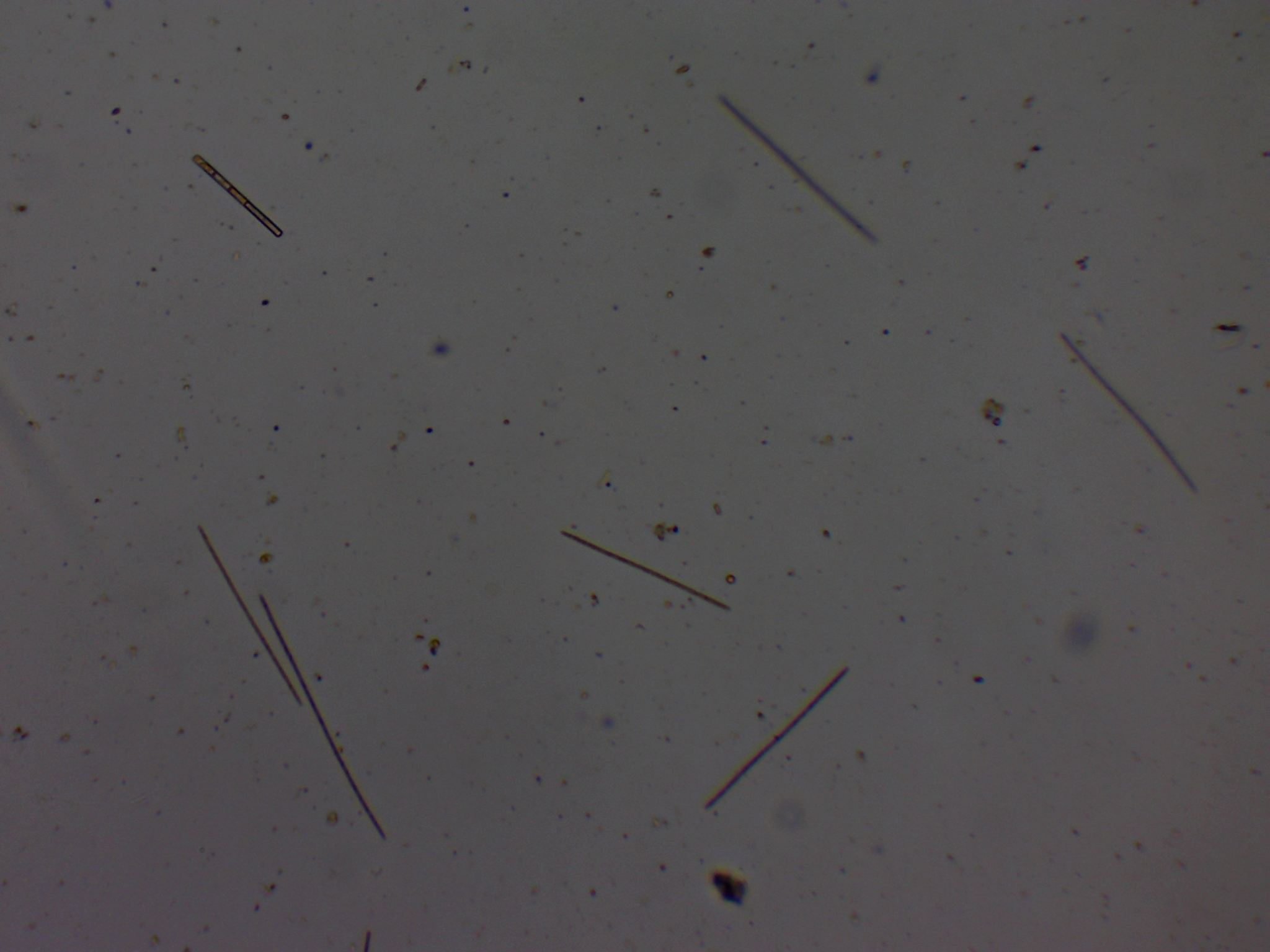 Planktothrix Anagnostidis & Komárek, 1988